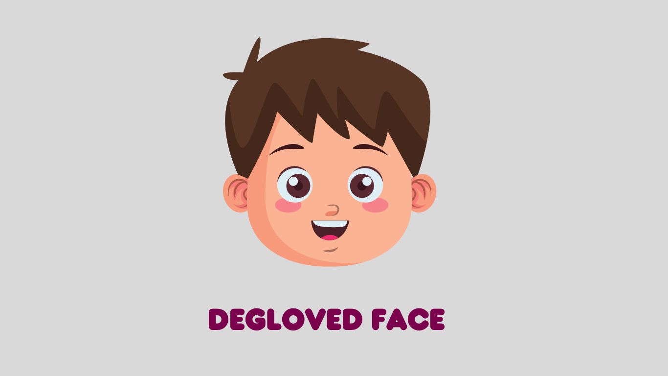 Degloved Face Explained: Causes, Symptoms & Treatment